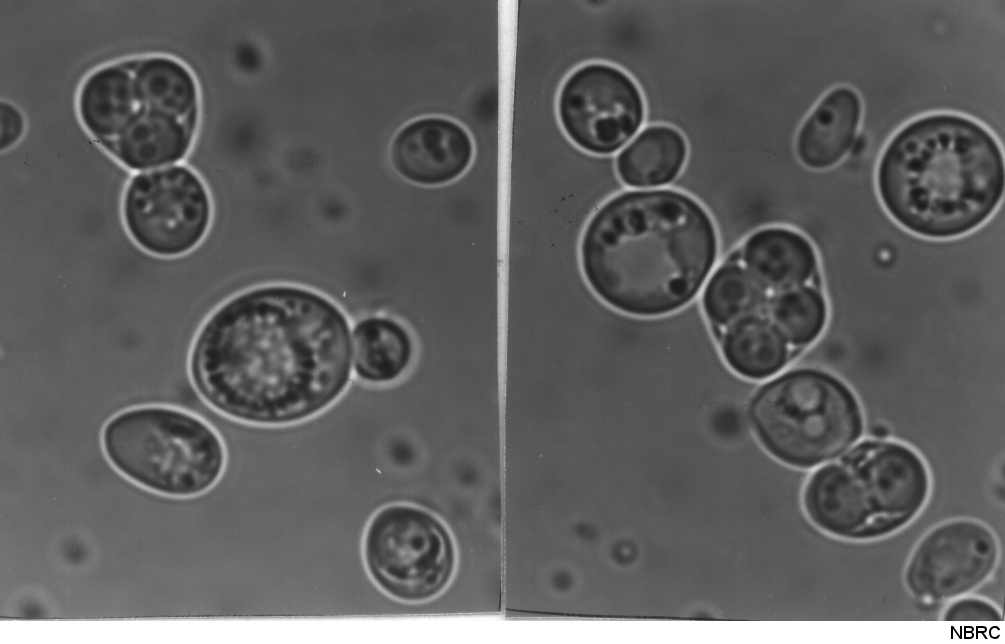 1334 [NITE NBRC Yeast Image Collection]