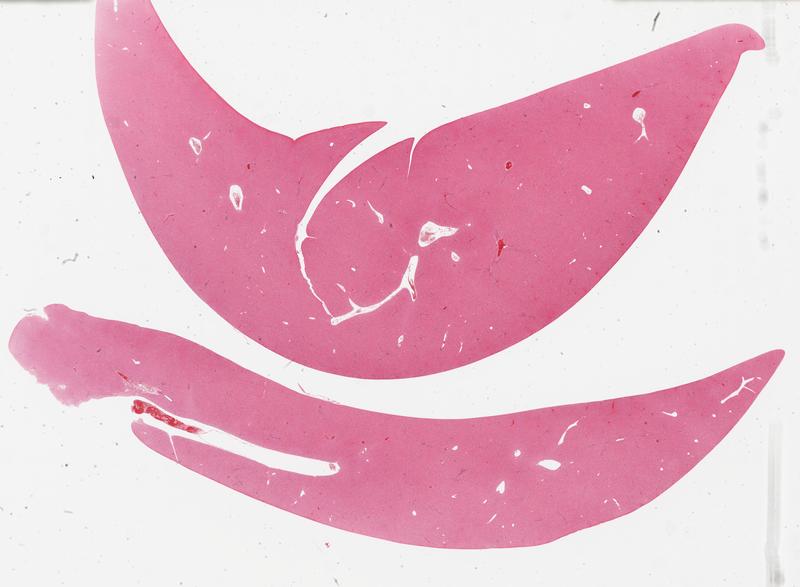 0040011LR [Open TG-GATEs - 病理写真情報]